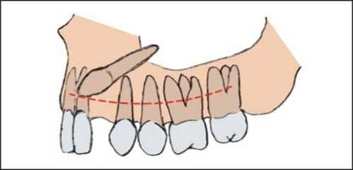 Οδοντοφατνιακή Χειρουργική - Facial-Oral-Surgery.gr