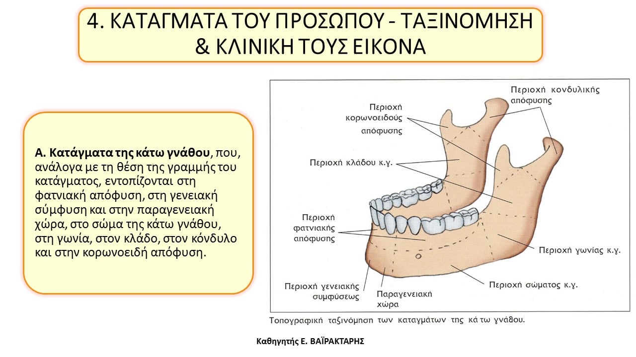 Κατάγματα κάτω γνάθου - Facial Oral Surgery - Βαϊρακτάρης Ελευθέριος